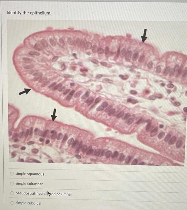 Solved Identify the epithelium. simple squamous simple | Chegg.com