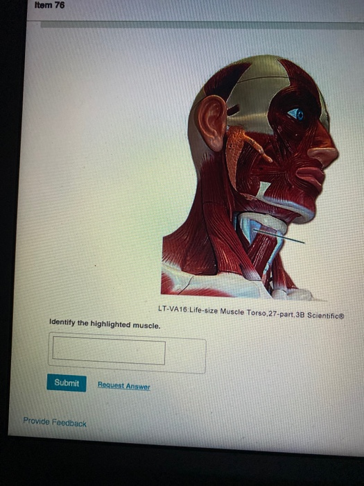 Solved Item 76 LT-VA16 Life-size Muscle Torso, 27-part, 3B | Chegg.com