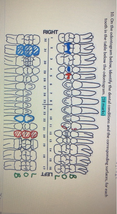 10. On the odontogram below, identify the dental | Chegg.com