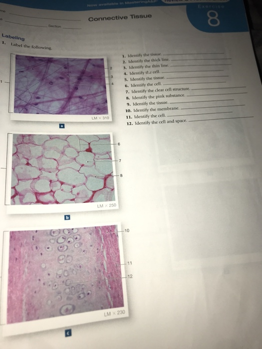 Solved Connective Tissue Labeling 1. Label the following 1. | Chegg.com