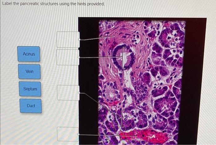 Solved Label the pancreatic structures using the hints | Chegg.com