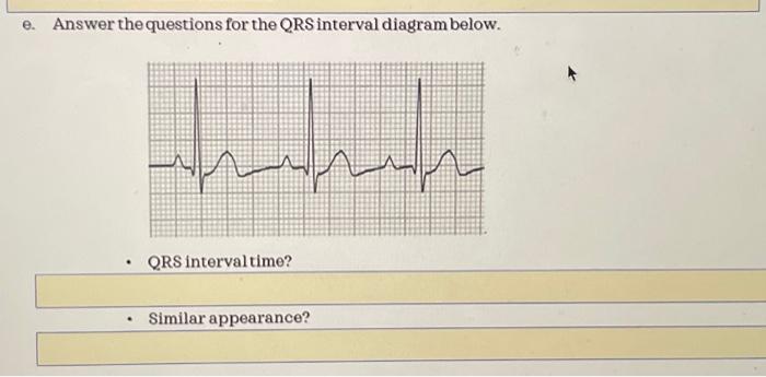 Solved e. Answer the questions for the QRS interval diagram | Chegg.com