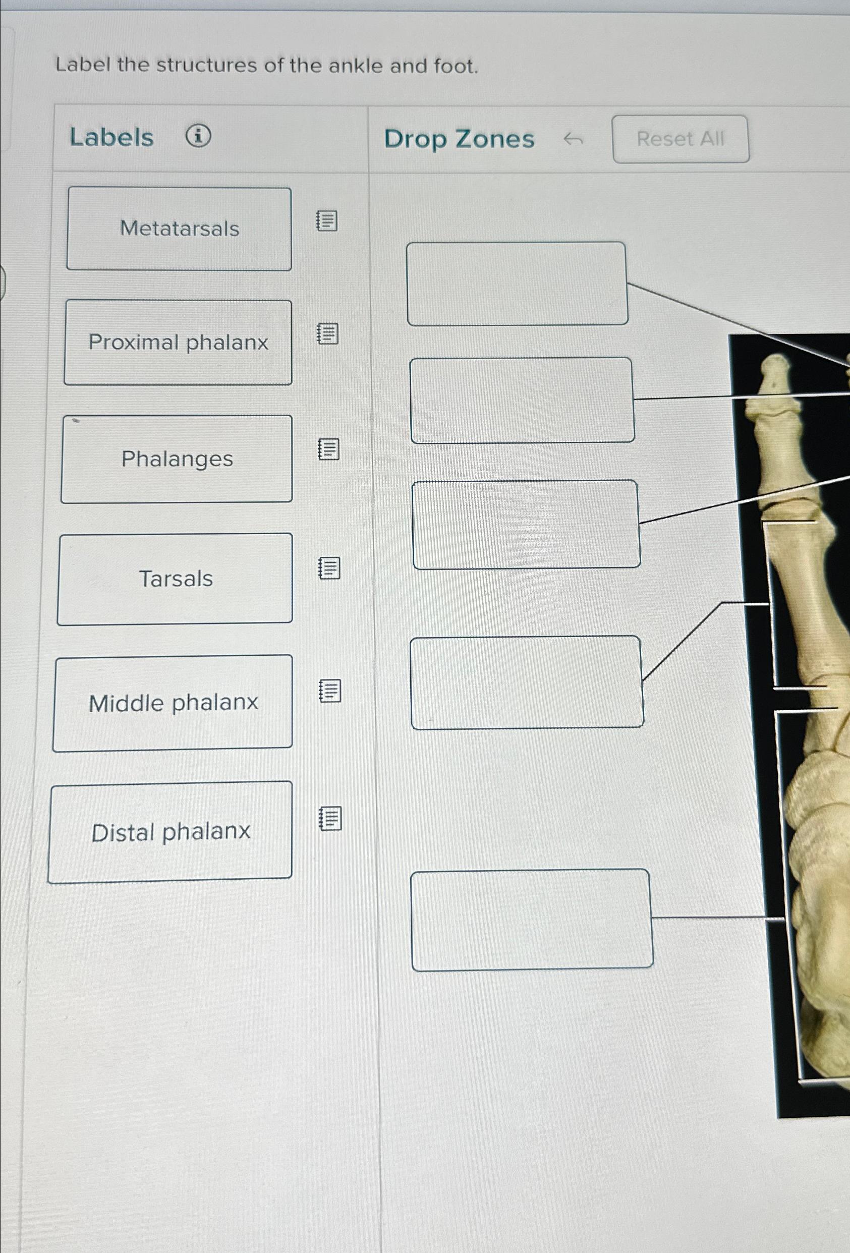 Solved Label the structures of the ankle and | Chegg.com