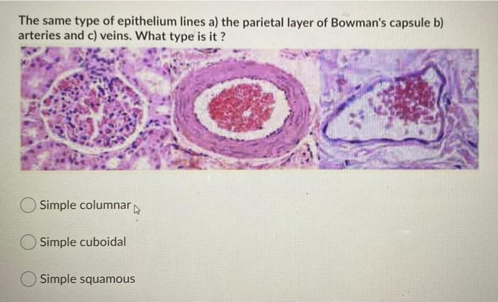 Solved The same type of epithelium lines a) the parietal | Chegg.com