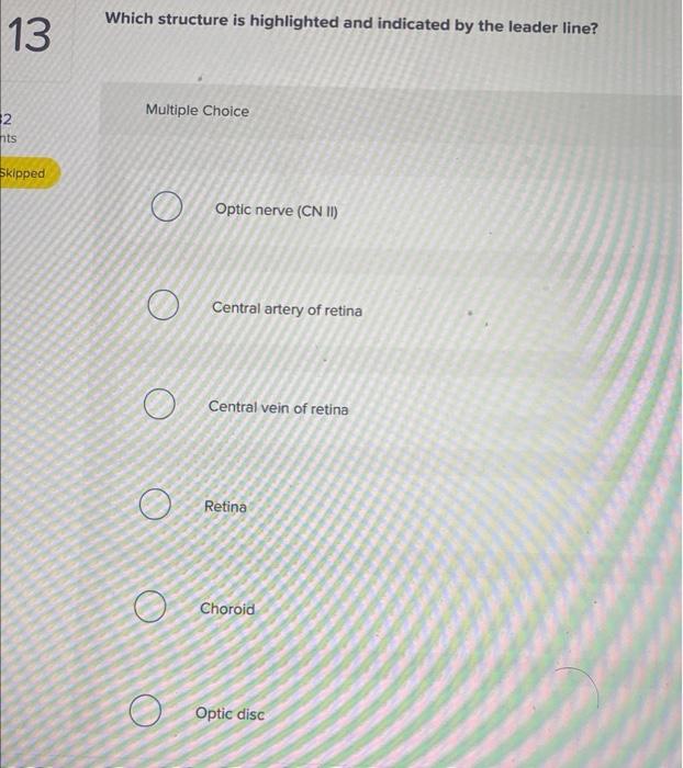 Solved Which structure is highlighted and indicated by the | Chegg.com