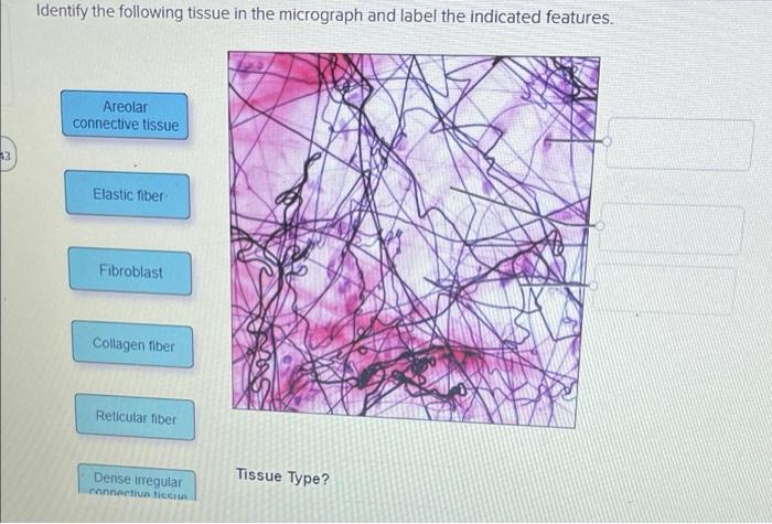 Solved Identify the following tissue in the micrograph and | Chegg.com Solved Identify the following tissue in the micrograph and | Chegg.com