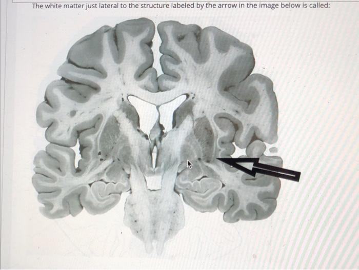 Solved The white matter just lateral to the structure | Chegg.com