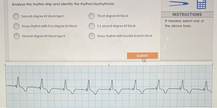 Solved Analyze this rhythm strip and identify the | Chegg.com