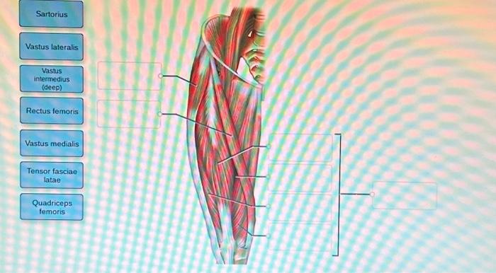 Solved Vastus lateralis Vastus intermedius (deep) Rectus | Chegg.com