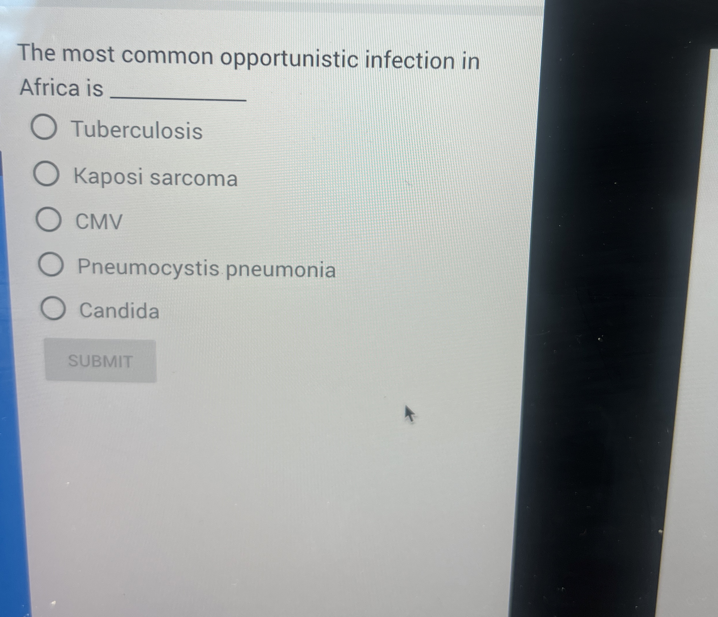 Solved The most common opportunistic infection in Africa is | Chegg.com