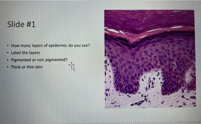 Solved Slide #1 • How many layers of epidermis do you see? • | Chegg.com