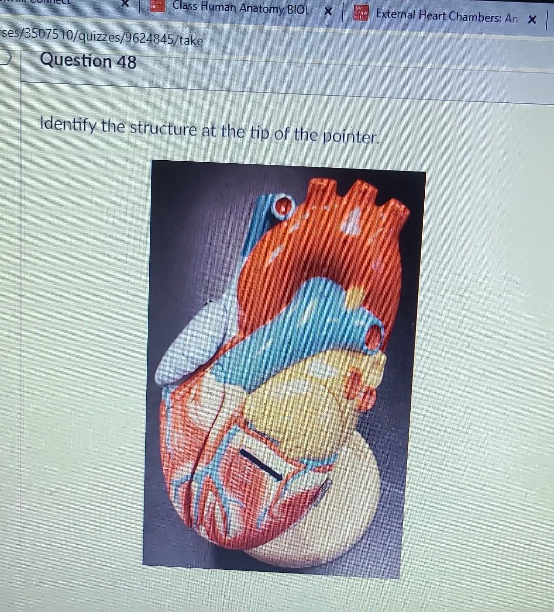 Solved Identify the structure at the tip of the | Chegg.com