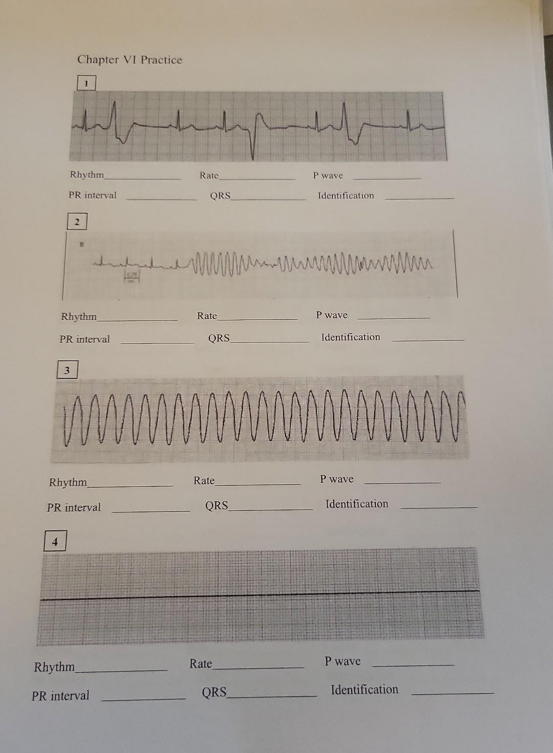 Chapter VI Practice Rhythm Rate P wave PR interval | Chegg.com