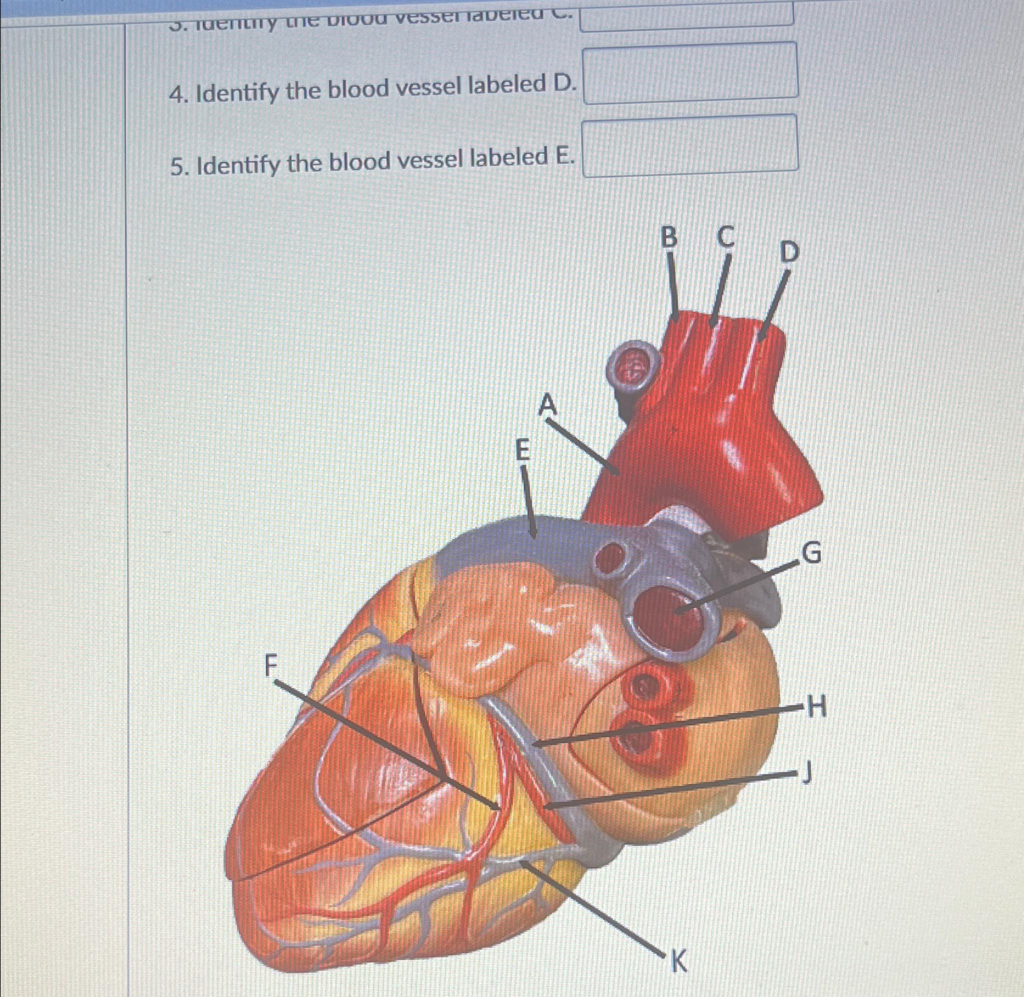 Solved Identify the blood vessel labeled D.Identify the | Chegg.com