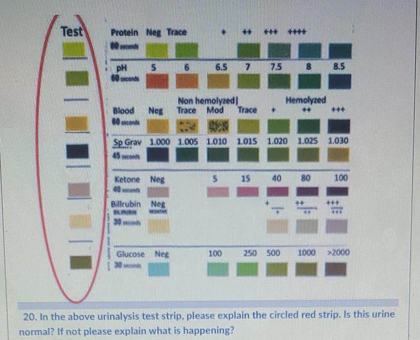 Solved Test Protein Nex Trace + pH 5 6 615 7 7.5 8 8.5 Non | Chegg.com