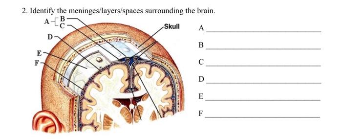 Solved 2. Identify the meninges/layers/spaces surrounding | Chegg.com