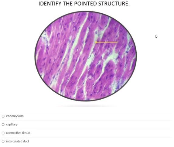 Solved IDENTIFY THE STRUCTURE POINTED. Hypothalamus Thalamus | Chegg.com