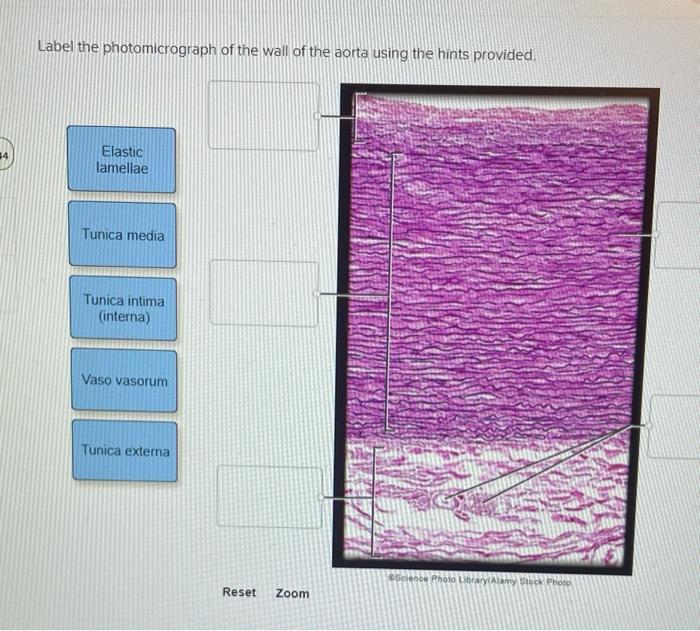 Solved Label the photomicrograph of the wall of the aorta | Chegg.com