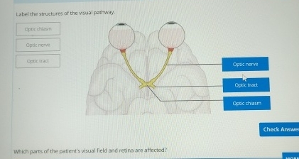 Solved Label the structures of the visual pathway.Which | Chegg.com