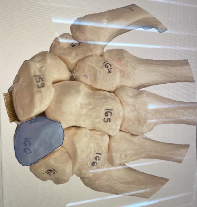 Solved Lunate Capitate Scaphoid Trapezoid Trapezium | Chegg.com