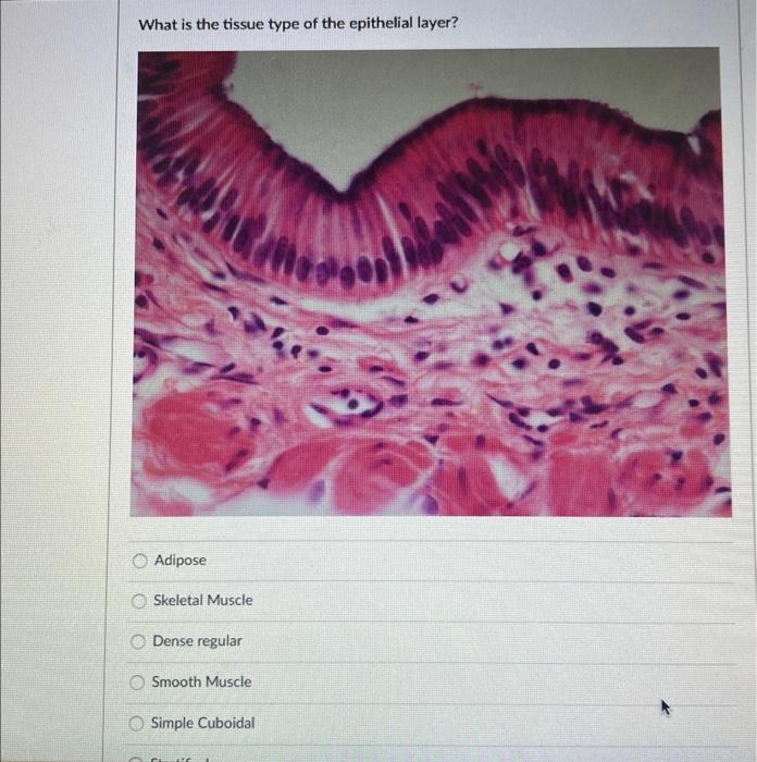 dense regular connective tissue pseudo stratified | Chegg.com