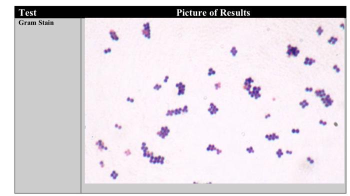 Alcaligenes Faecalis Gram Stain