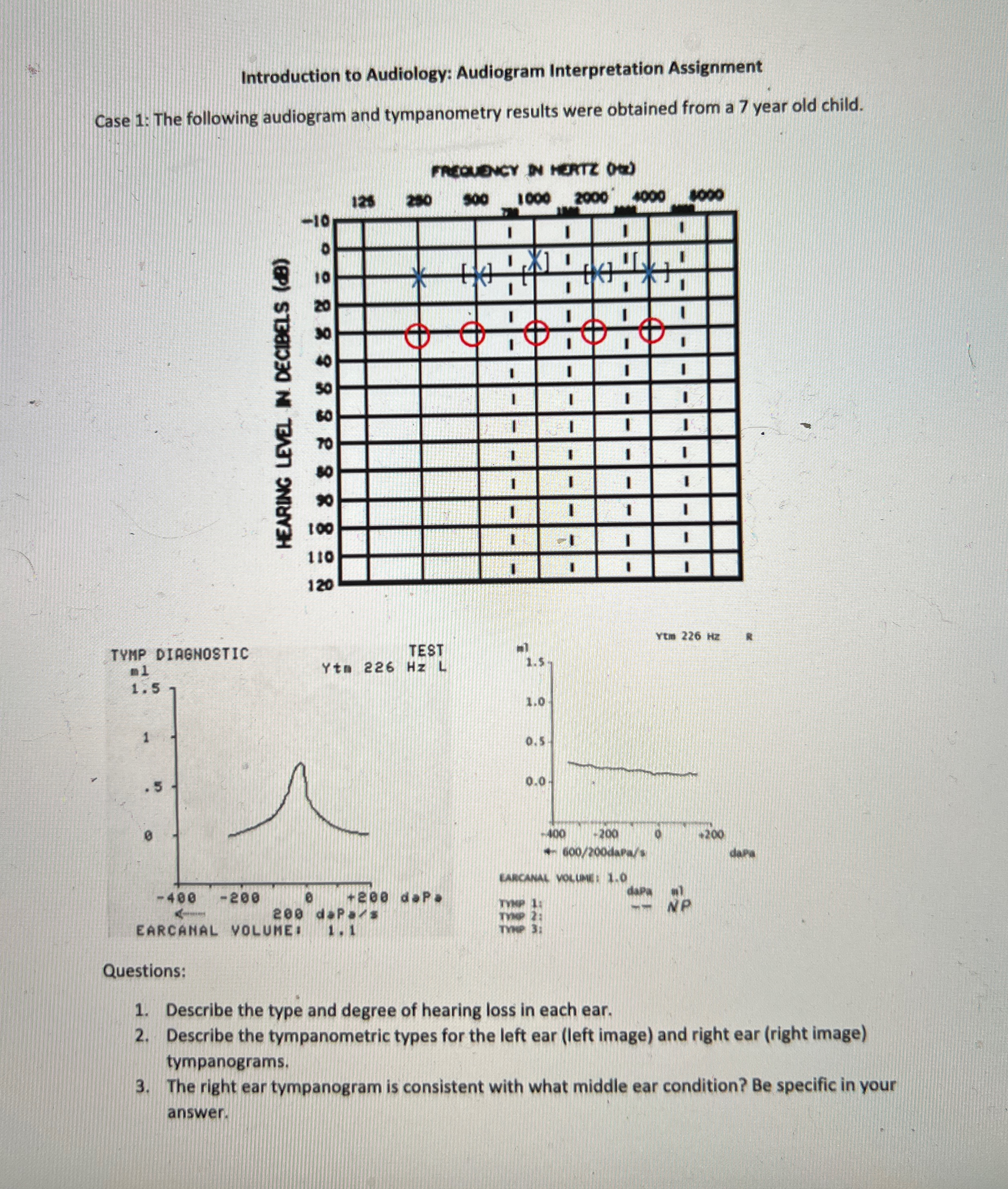 Introduction to Audiology: Audiogram Interpretation | Chegg.com