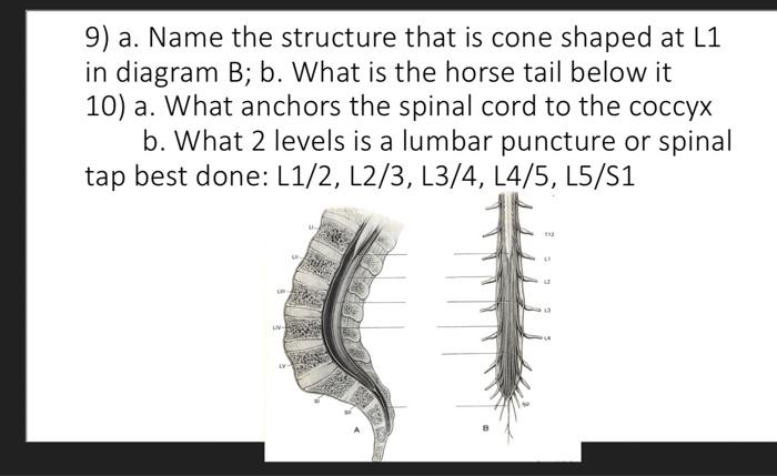 Solved 9) a. Name the structure that is cone shaped at L1 in | Chegg.com