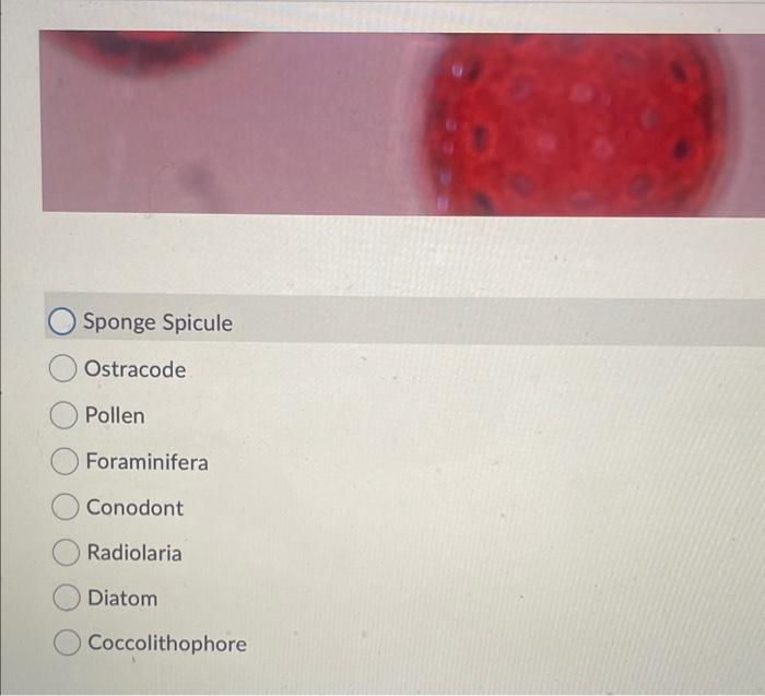 Solved Identify the microfossil pictured | Chegg.com