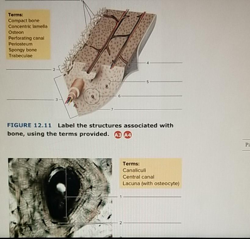 Solved Terms: Compact bone Concentric lamella Osteon | Chegg.com