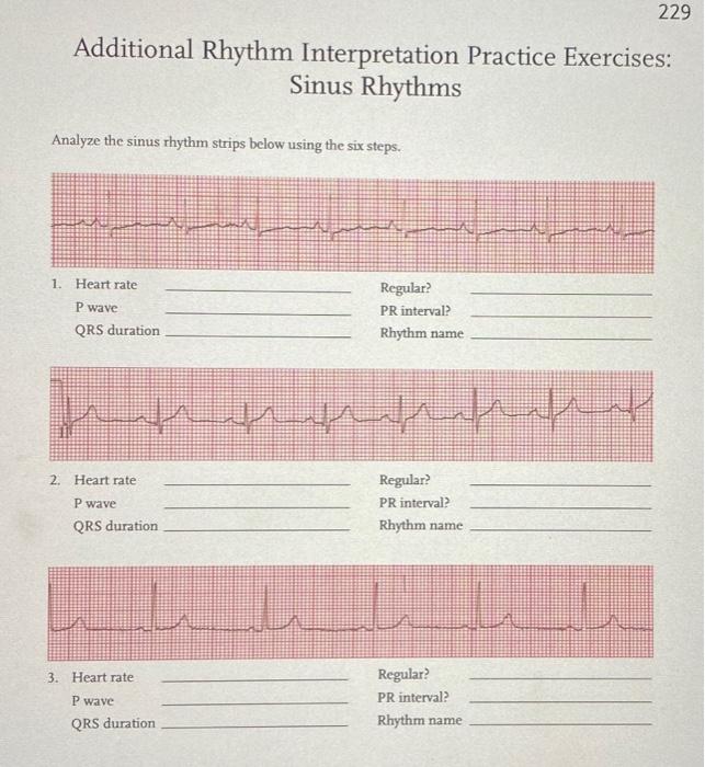 Solved Sinus Rhythms Analyze the sinus rhythm strips below | Chegg.com