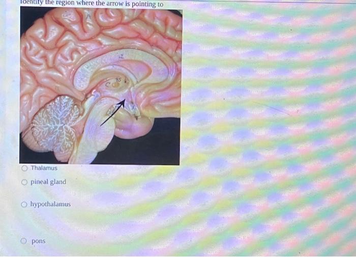 Solved Identify the region where the arrow is pointing to | Chegg.com