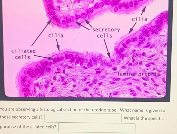 Solved and cilia Bebo secretory cells cilia ciliated cells | Chegg.com