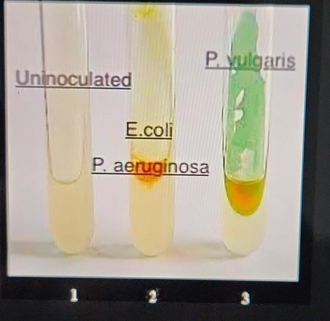 UREA AGAR P. vulgaris P. aeruginosa Uninoculated | Chegg.com