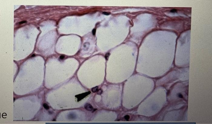 Solved Identify the tissue at the apical surfaces of the | Chegg.com
