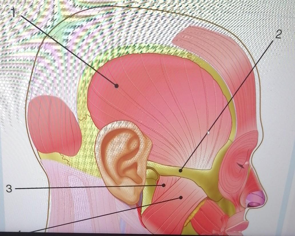 Solved IN 2 3 | Chegg.com