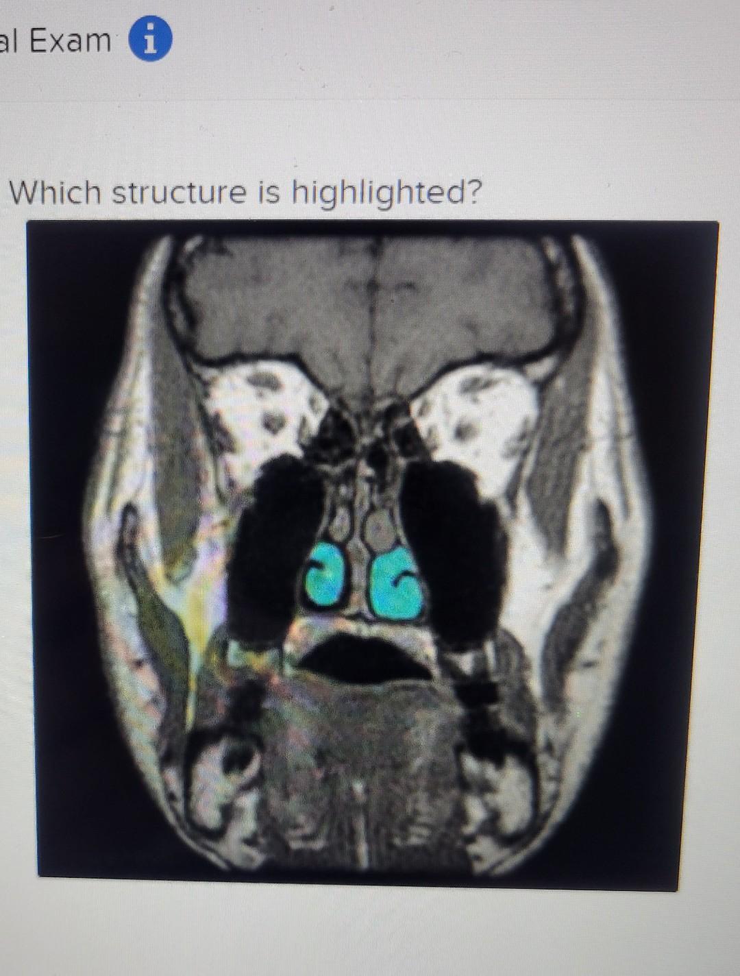 Solved Exam Which strusture is hiahliahted?Cumulative Final | Chegg.com