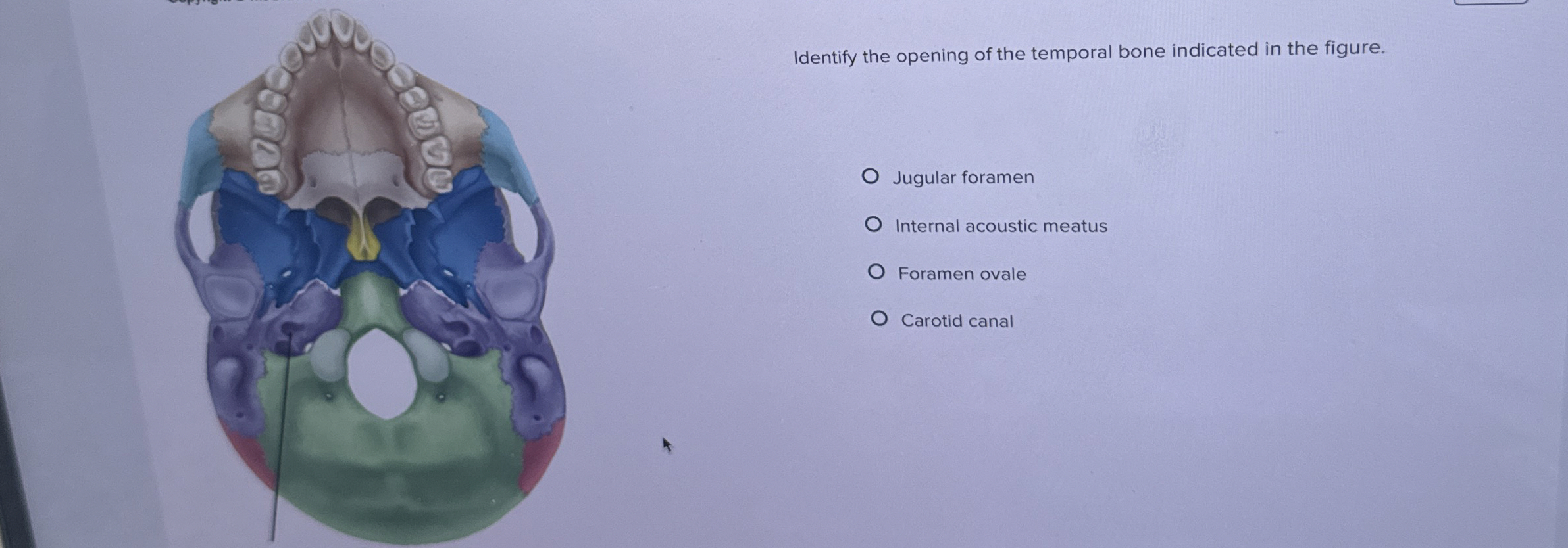Solved Identify the opening of the temporal bone indicated | Chegg.com