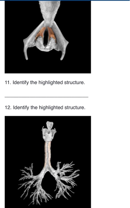 Solved 11. Identify the highlighted structure. 12. Identify | Chegg.com