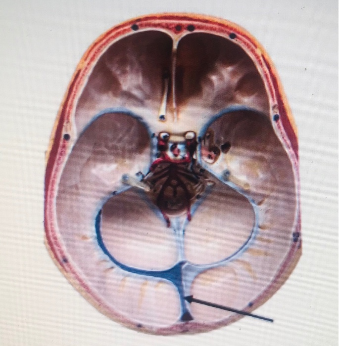 Solved Name the Structure the arrow is pointing to.a. pia | Chegg.com