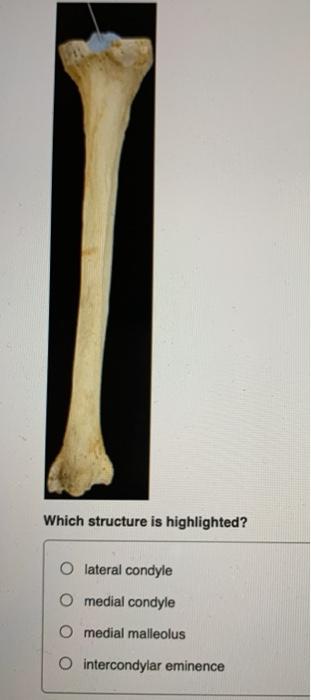 Solved Which structure is highlighted? O acromial end O | Chegg.com