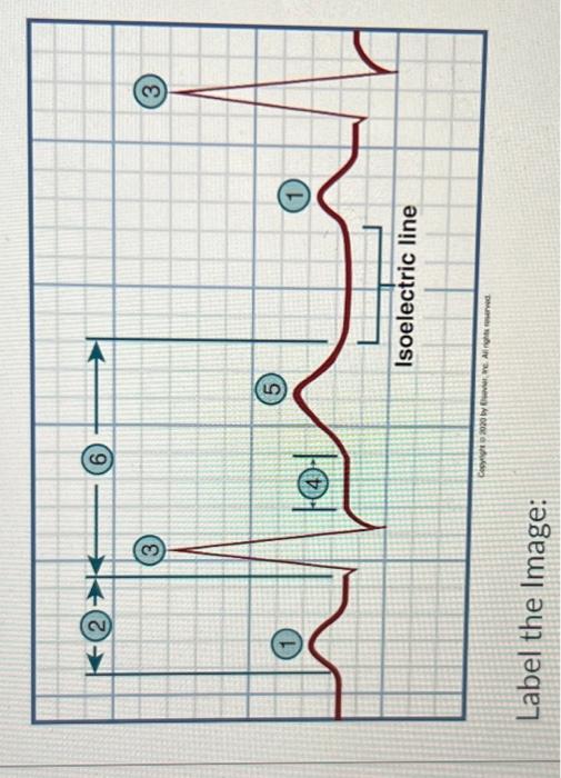 Solved Label the Image: | Chegg.com