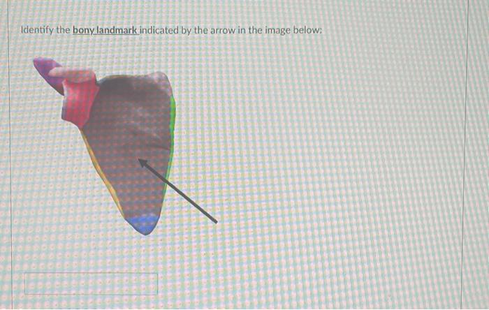 Solved Identify the bony landmark indicated by the arrow in | Chegg.com