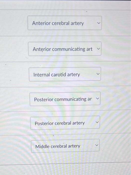 Solved Anterior cerebral artery Anterior communicating art | Chegg.com