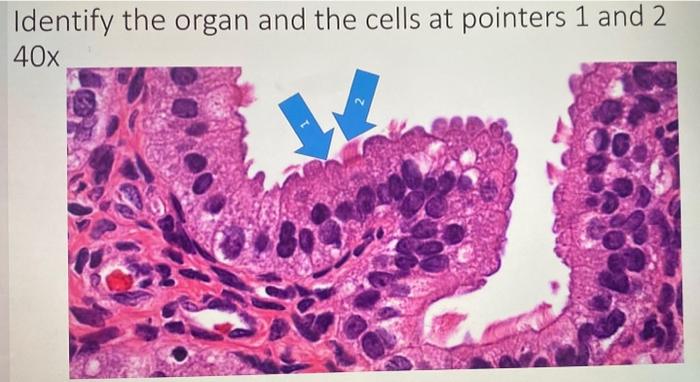 Solved Identify the organ and the cells at pointers 1 and 2 | Chegg.com