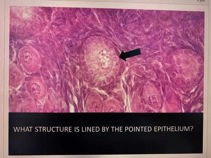 Solved IDENTIFY POINTED STRUCTURE WHAT STRUCTURE IS LINED | Chegg.com