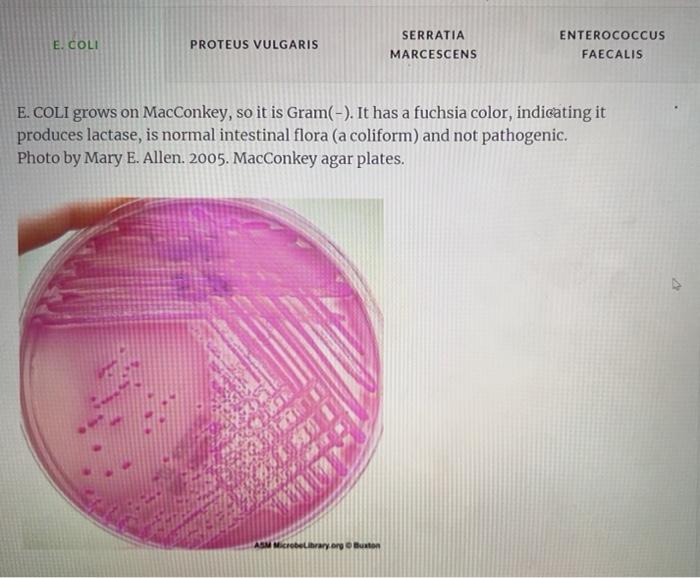 Enterococcus Faecalis Macconkey Agar