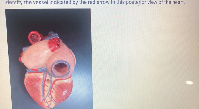 Solved Identify the vessel indicated by the red arrow in | Chegg.com