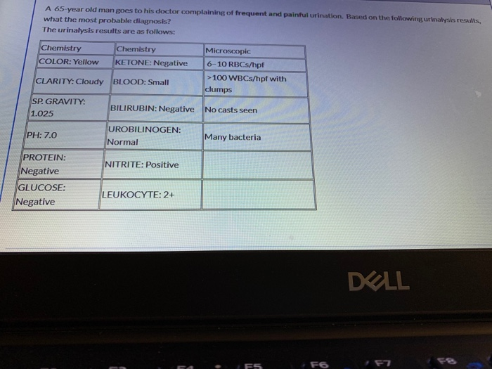 Solved A physician suspects a fetus may be suffering from | Chegg.com