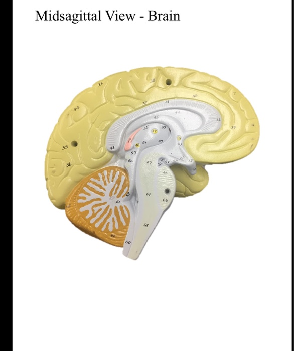 Midsagittal View - Brain 106 10 10 lod 10 | Chegg.com